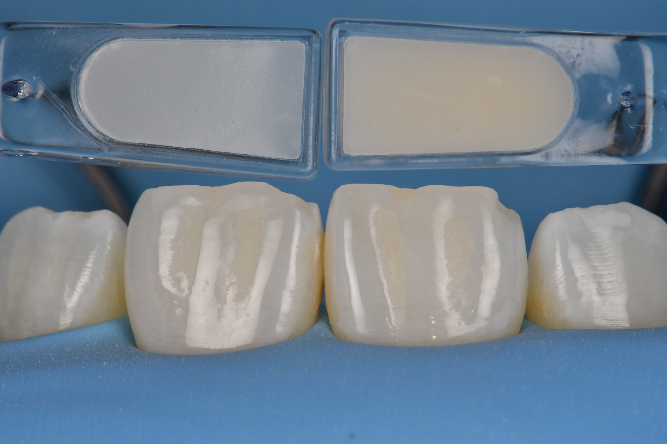 Dehydration and Edge Bonding Considerations