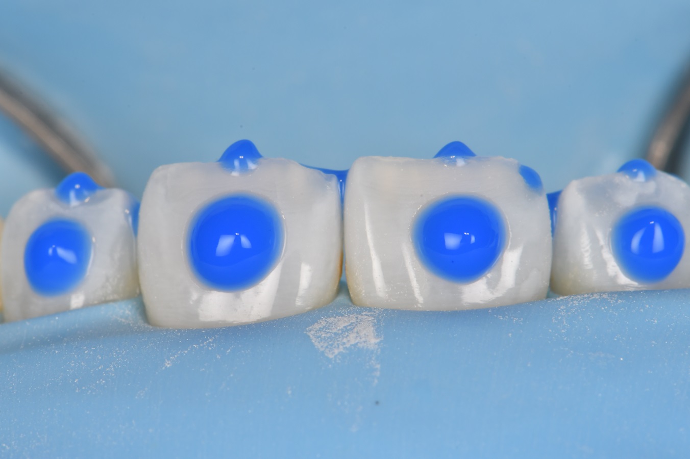 Dehydration and Edge Bonding Considerations