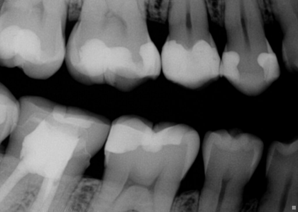 Optimizing Proximal Axial Contours with Garrison